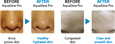 AquaDew Pro - Men's Skin Centres